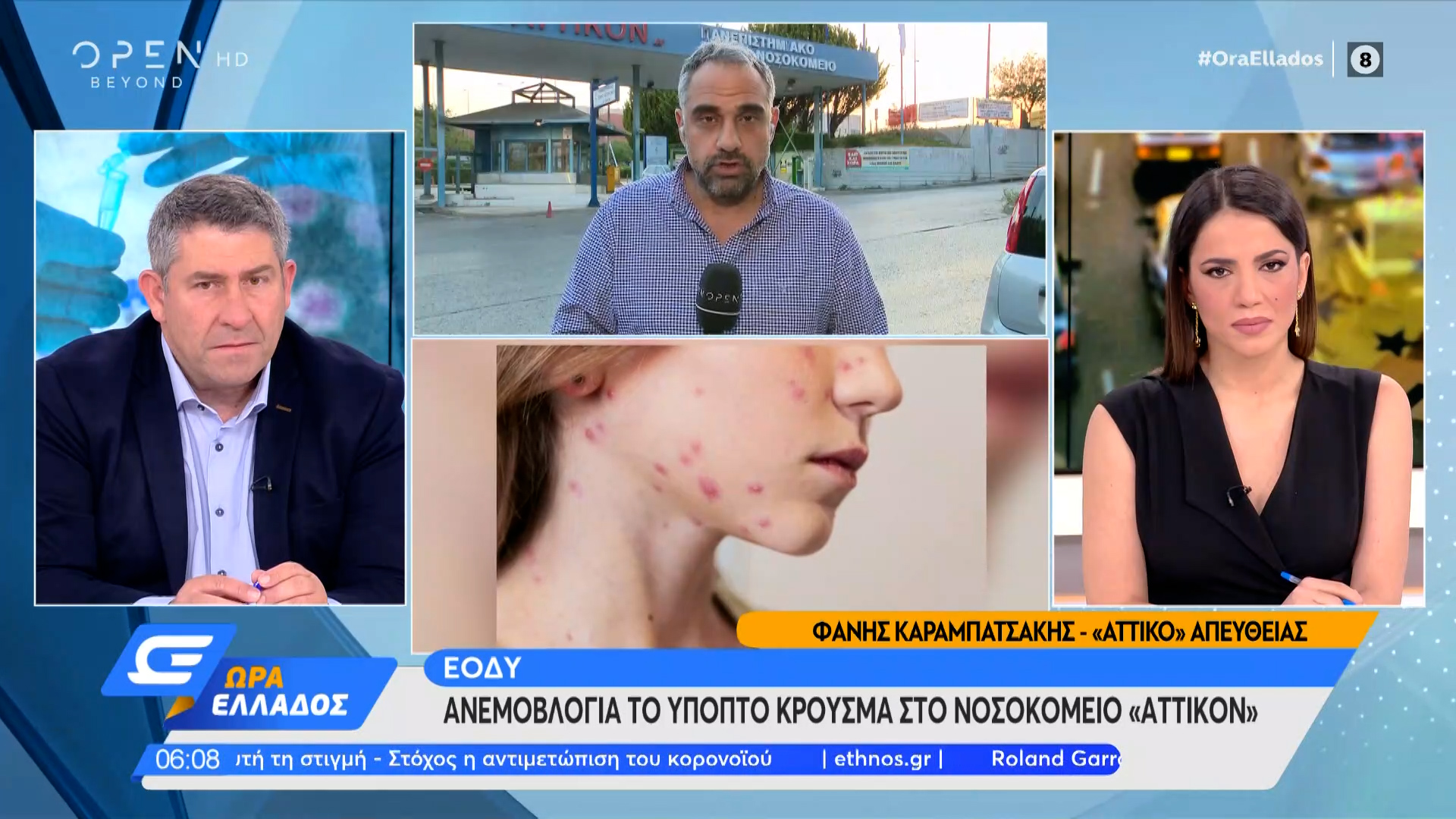 Ανεμοβλογιά το ύποπτο κρούσμα ευλογιάς των πιθήκων στο νοσοκομείο ...