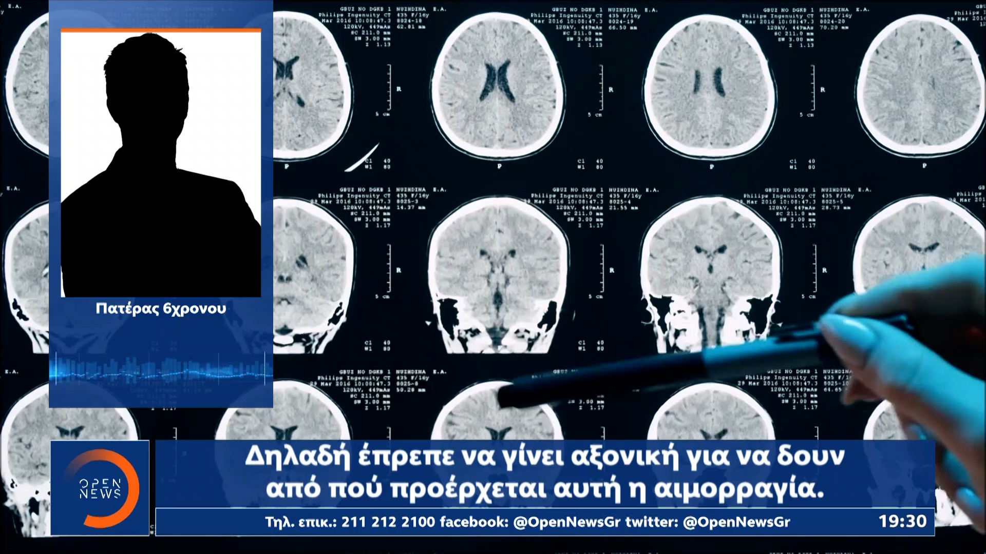 «Οδύσσεια» για τραυματισμένο 6χρονο: Δεν υπήρχε διαθέσιμο μηχάνημα για ...