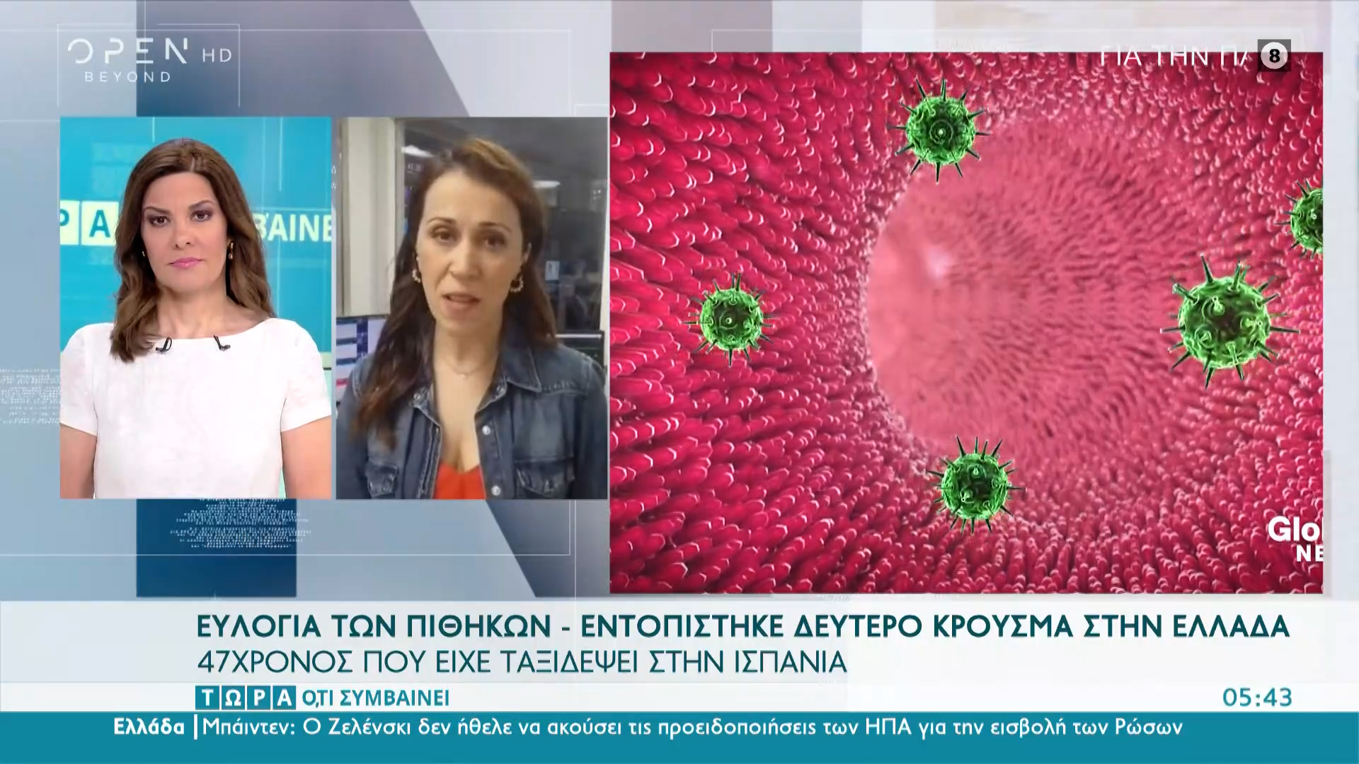 Ευλογιά των πιθήκων: Εντοπίστηκε δεύτερο κρούσμα στην Ελλάδα | OPEN TV