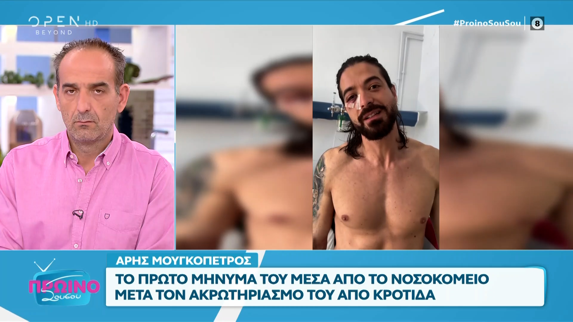 Άρης Μουγκοπέτρος: Το πρώτο μήνυμά του μετά τον ακρωτηριασμό του από ...
