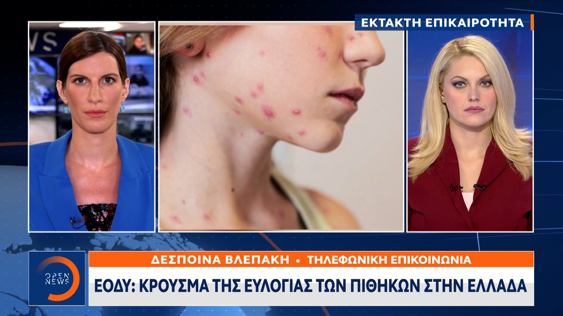 Έκτακτο Δελτίο: ΕΟΔΥ: Κρούσμα της ευλογιάς των πιθήκων στην Ελλάδα ...
